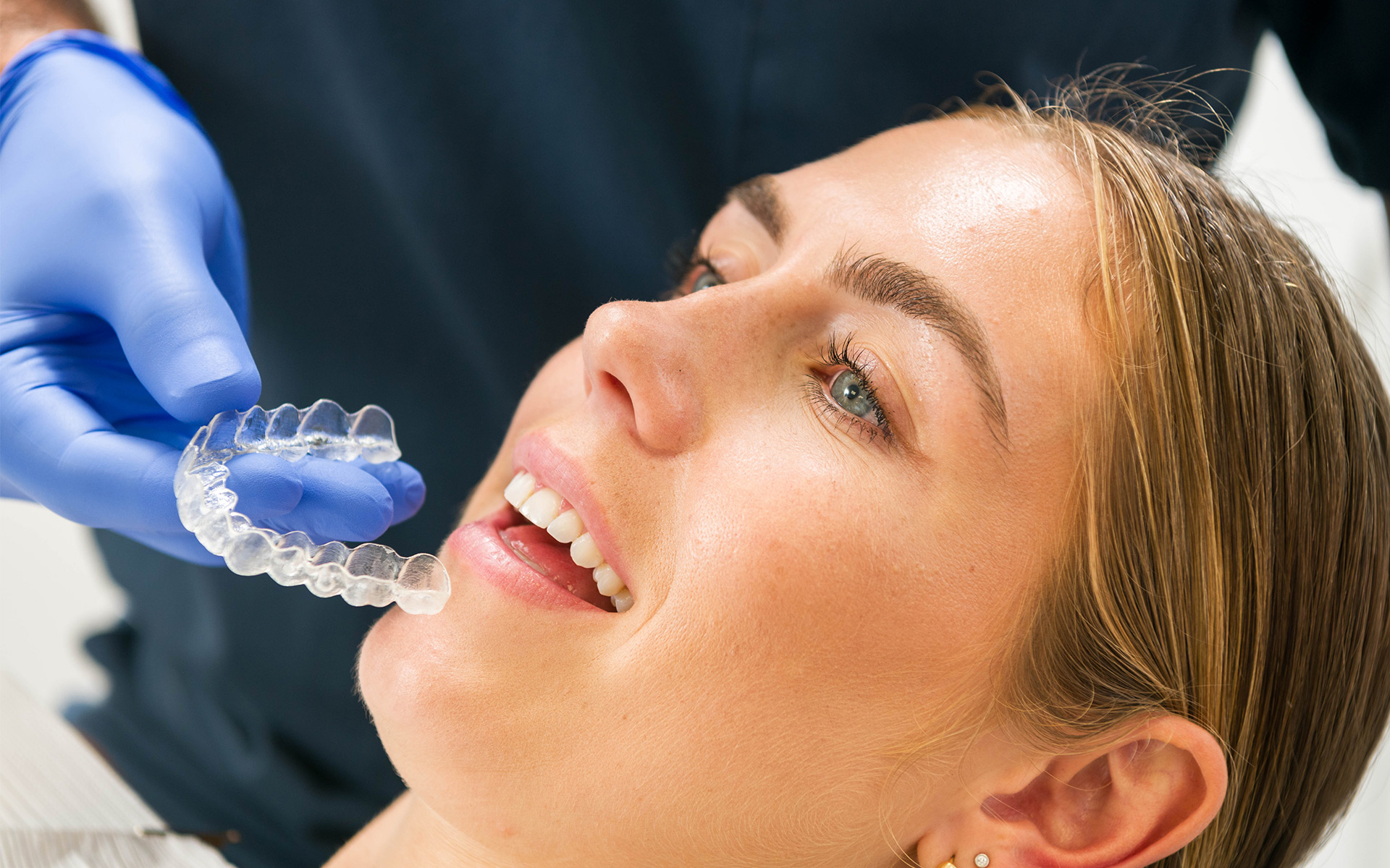 Invisalign - Exeter - Inspired Dental Care